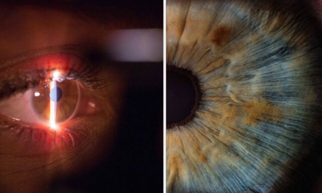 Comprehensive Eye Exam | LA & Culver City